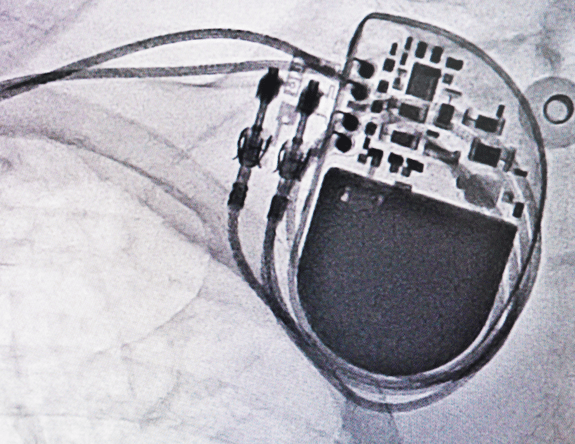 Industries | Rose Batteries